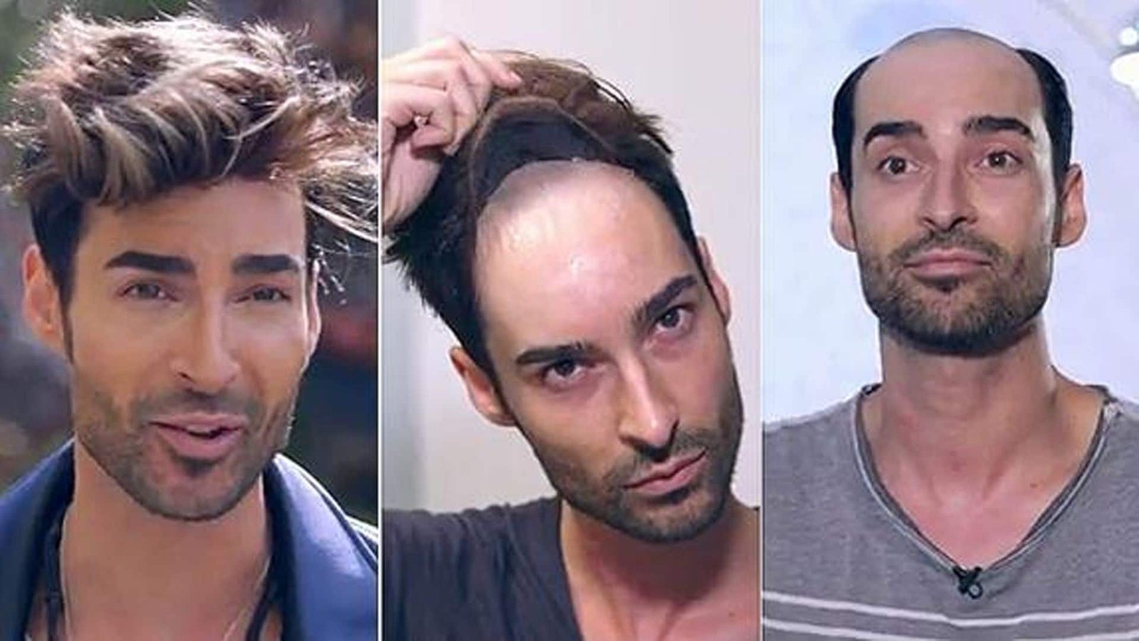 Prótesis capilares ⋆ ¿Son lo mismo que las pelucas?